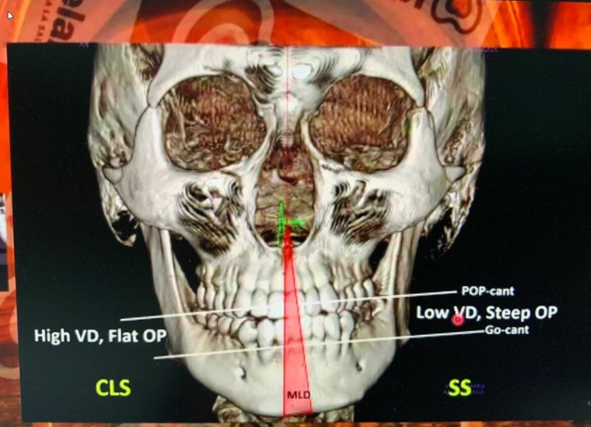 Curso de Ortodoncia Craneomandibular Sadao Sato en Sevilla - Travesí ...