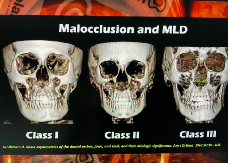 Curso de Ortodoncia Craneomandibular Sadao Sato en Sevilla - Travesí ...